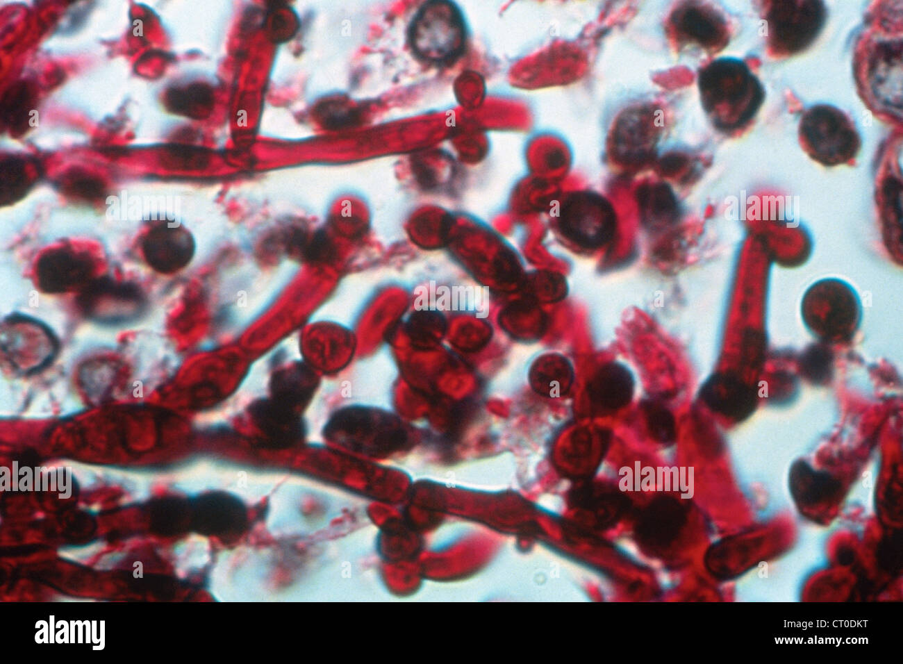 Candida albicans micrograph -Fotos und -Bildmaterial in hoher Auflösung ...