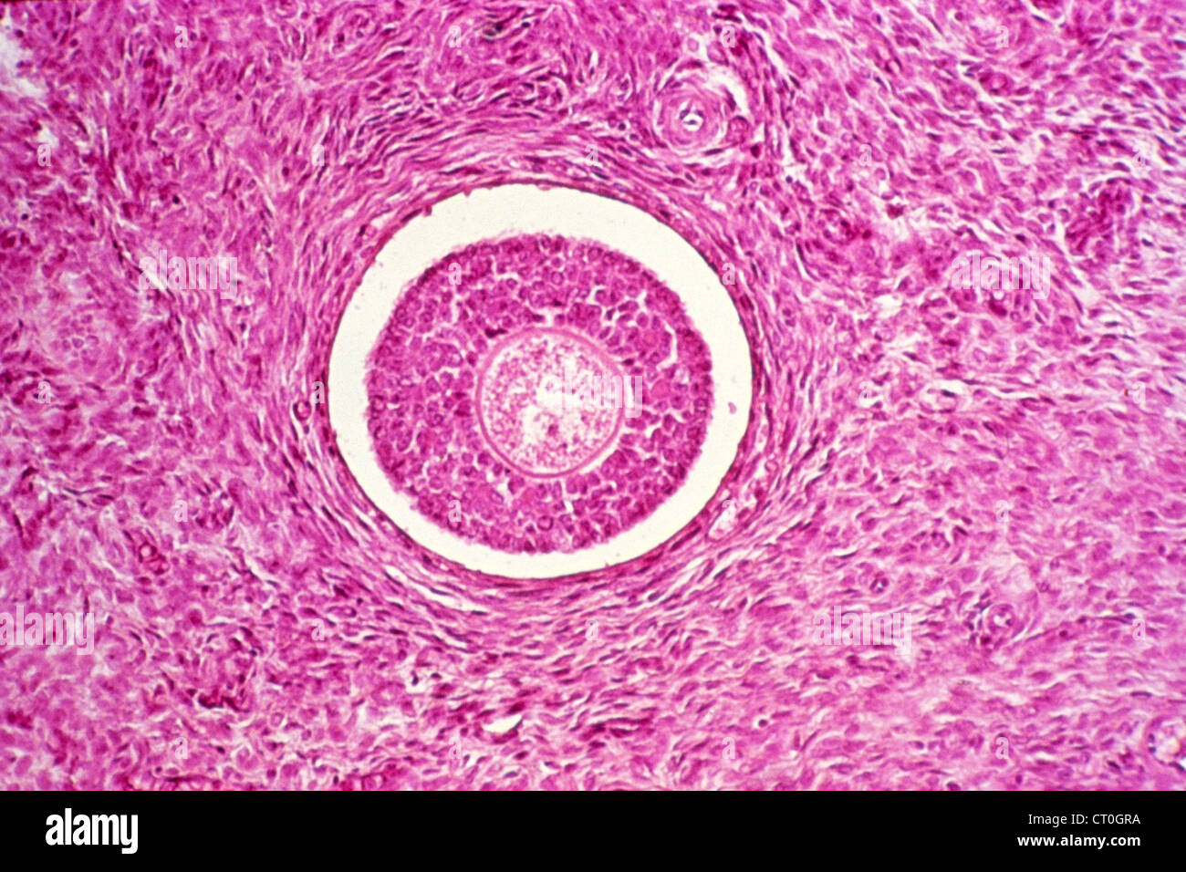 Ovarian follicle histology -Fotos und -Bildmaterial in hoher Auflösung ...