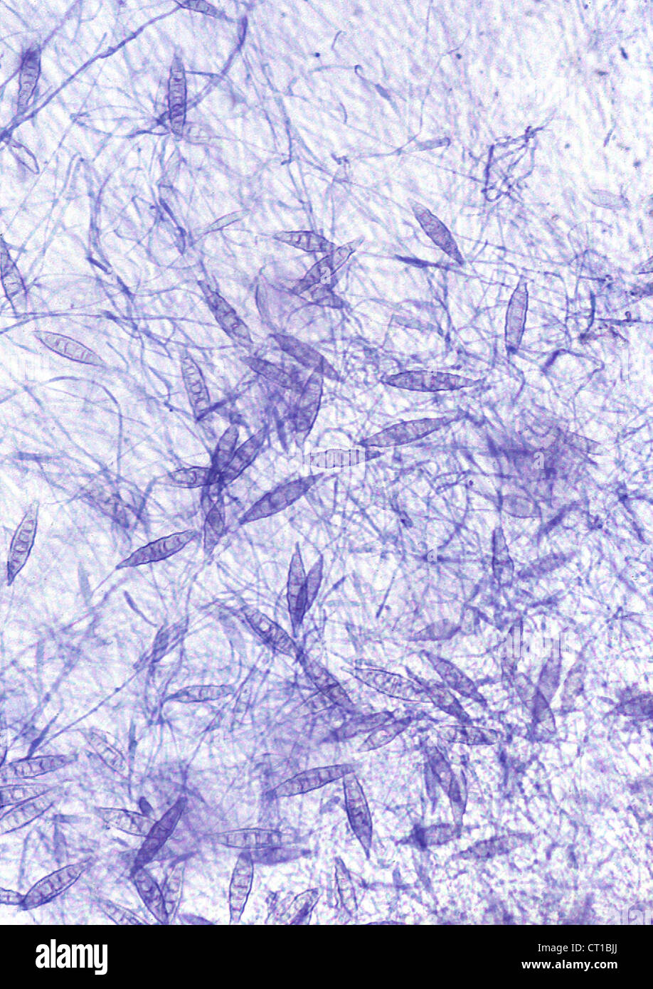 Microsporum canis -Fotos und -Bildmaterial in hoher Auflösung – Alamy