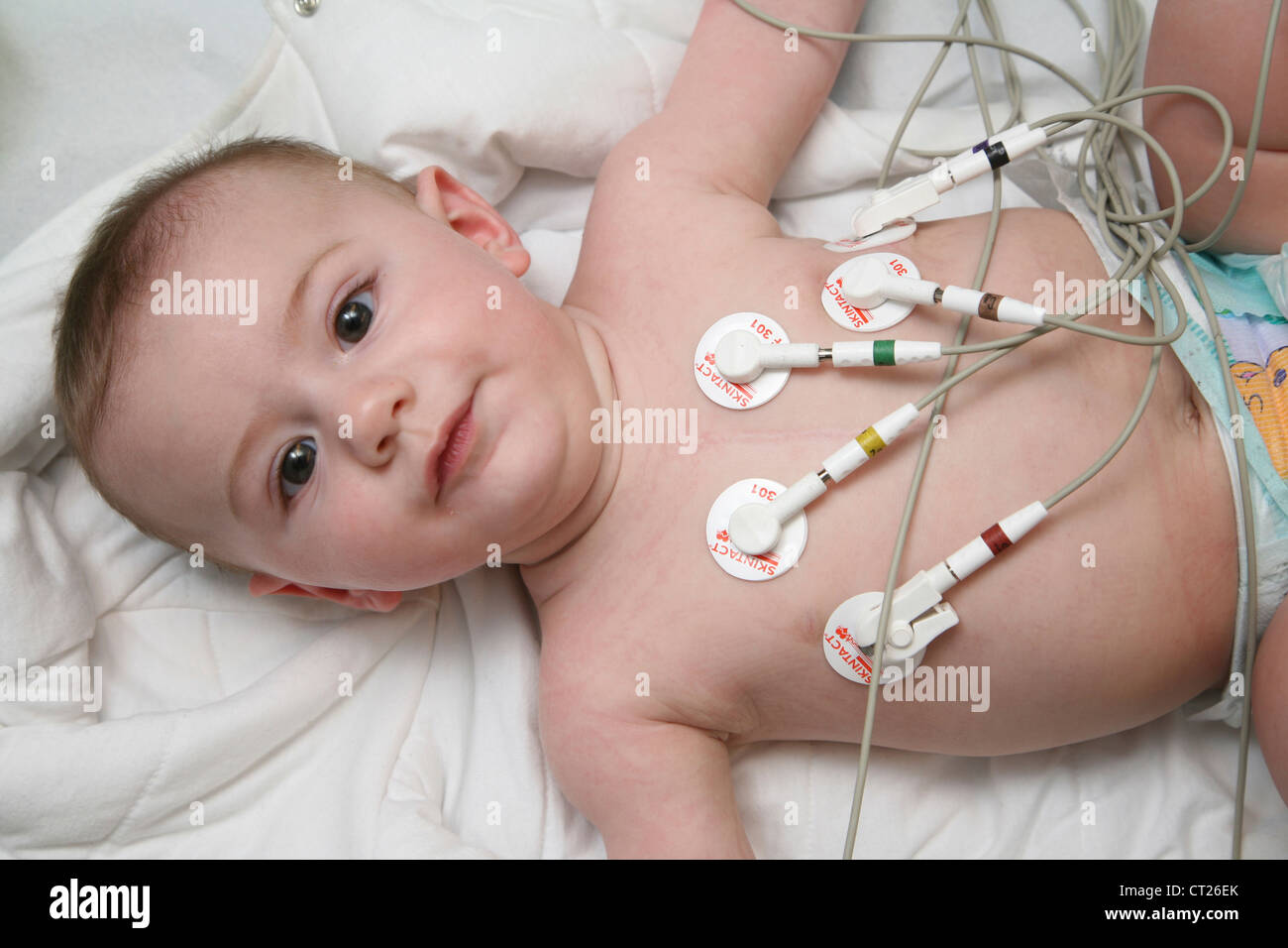 EKG EINES KINDES Stockfotografie - Alamy