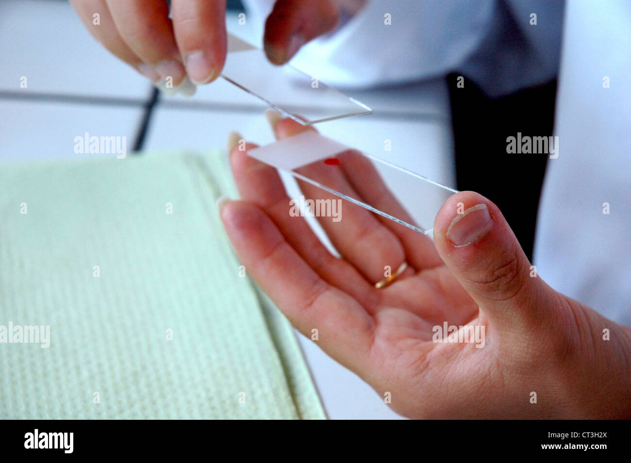 Blood smear micrograph -Fotos und -Bildmaterial in hoher Auflösung – Alamy