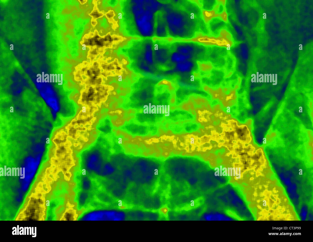 Vena iliaca interna -Fotos und -Bildmaterial in hoher Auflösung – Alamy