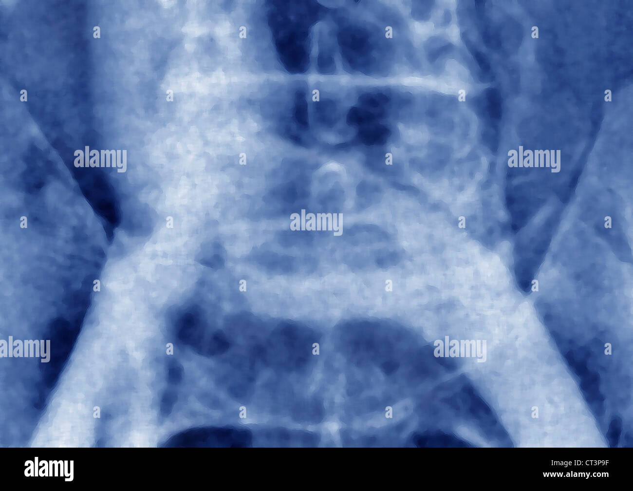 External iliac -Fotos und -Bildmaterial in hoher Auflösung – Alamy