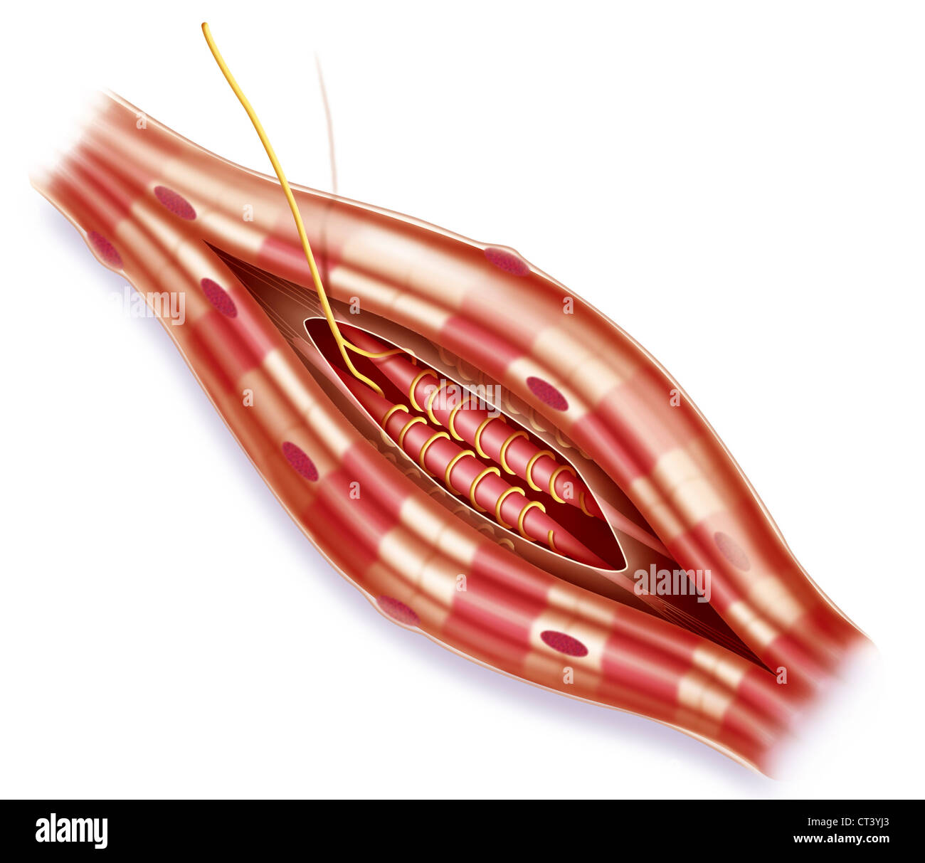 Spindle cells -Fotos und -Bildmaterial in hoher Auflösung – Alamy