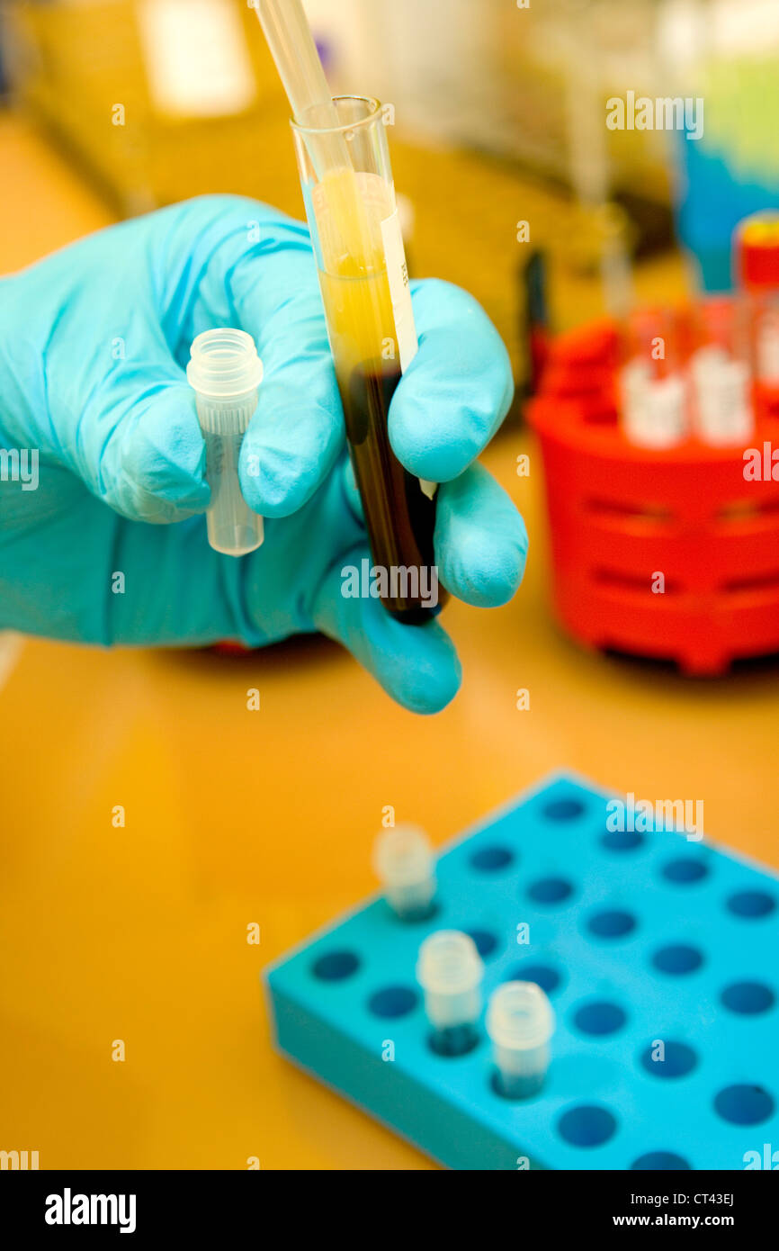 Blutserum röhrchen -Fotos und -Bildmaterial in hoher Auflösung – Alamy