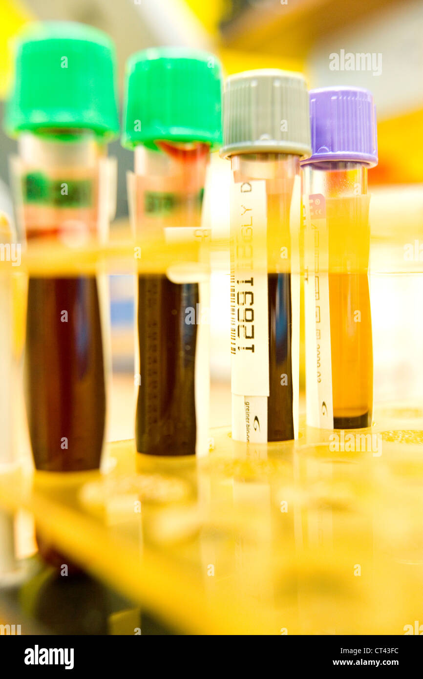 Blutserum röhrchen -Fotos und -Bildmaterial in hoher Auflösung – Alamy