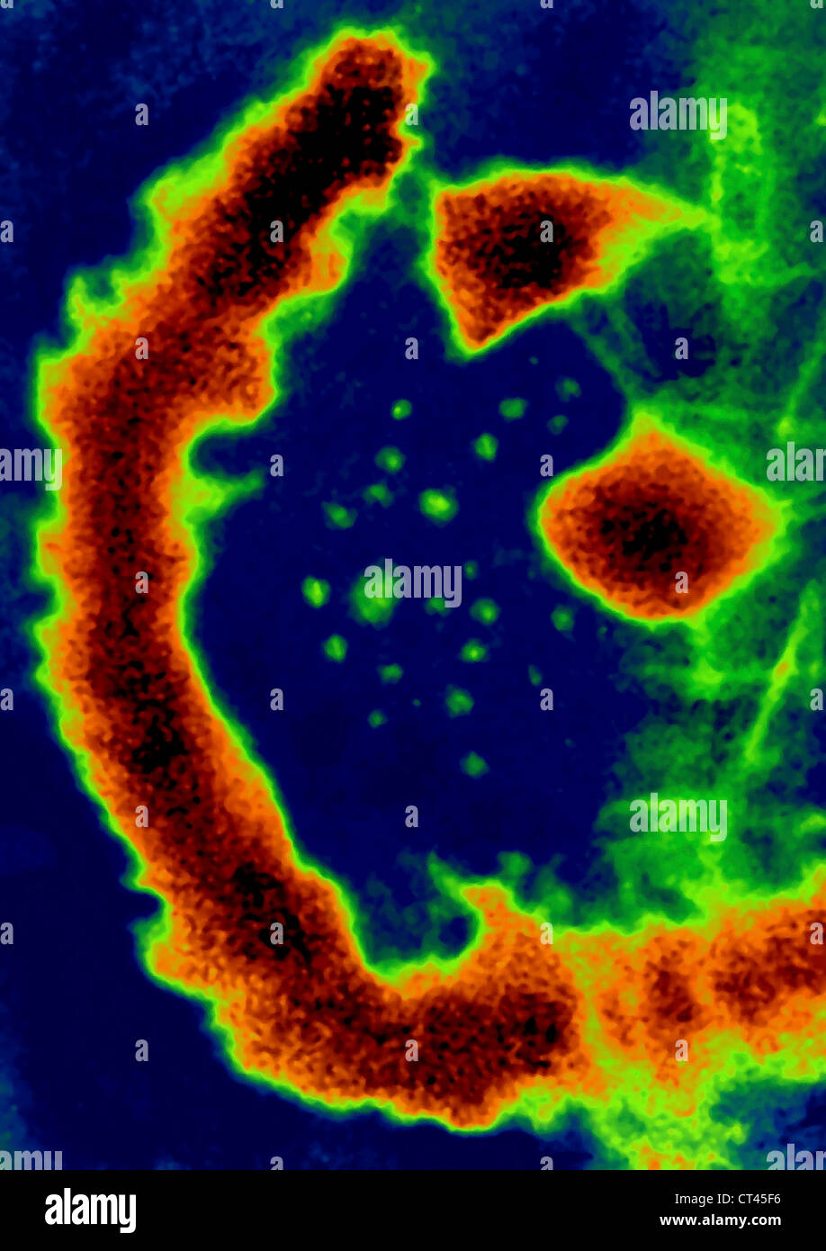 Pancreas x ray -Fotos und -Bildmaterial in hoher Auflösung – Alamy