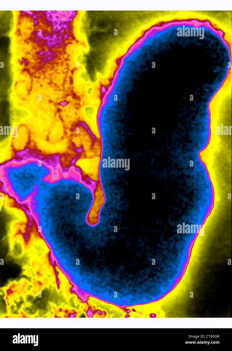 Pyloric antrum -Fotos und -Bildmaterial in hoher Auflösung – Alamy