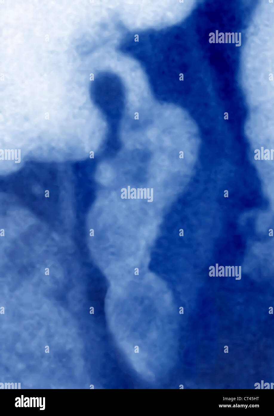 Darm Verdauungstrakt Fotos Stockfotos und -bilder Kaufen - Alamy