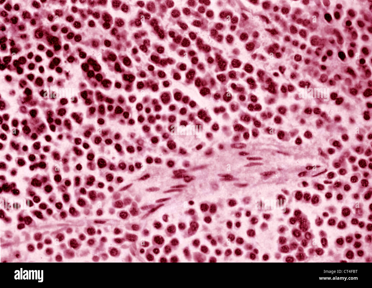 Bone light micrograph -Fotos und -Bildmaterial in hoher Auflösung – Alamy
