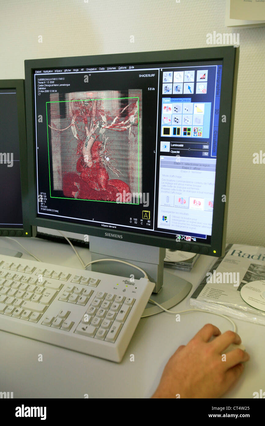 Herz computertomographie -Fotos und -Bildmaterial in hoher Auflösung ...