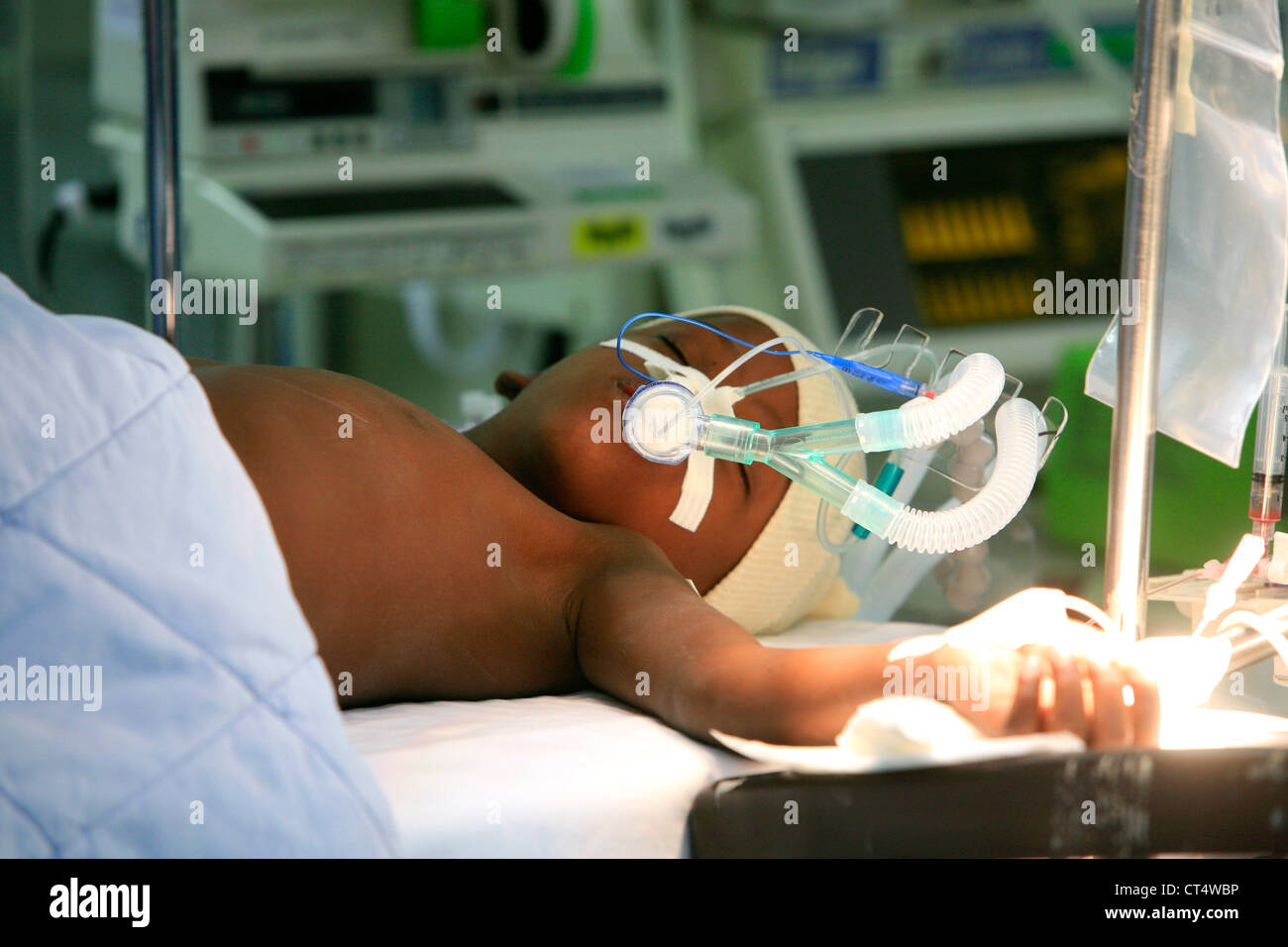Narkose kinder -Fotos und -Bildmaterial in hoher Auflösung – Alamy