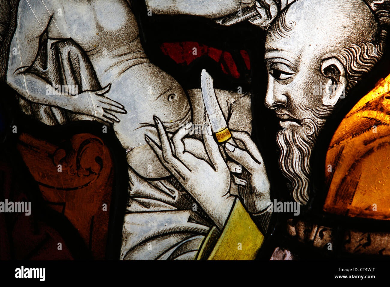 Operation circumcision -Fotos und -Bildmaterial in hoher Auflösung – Alamy