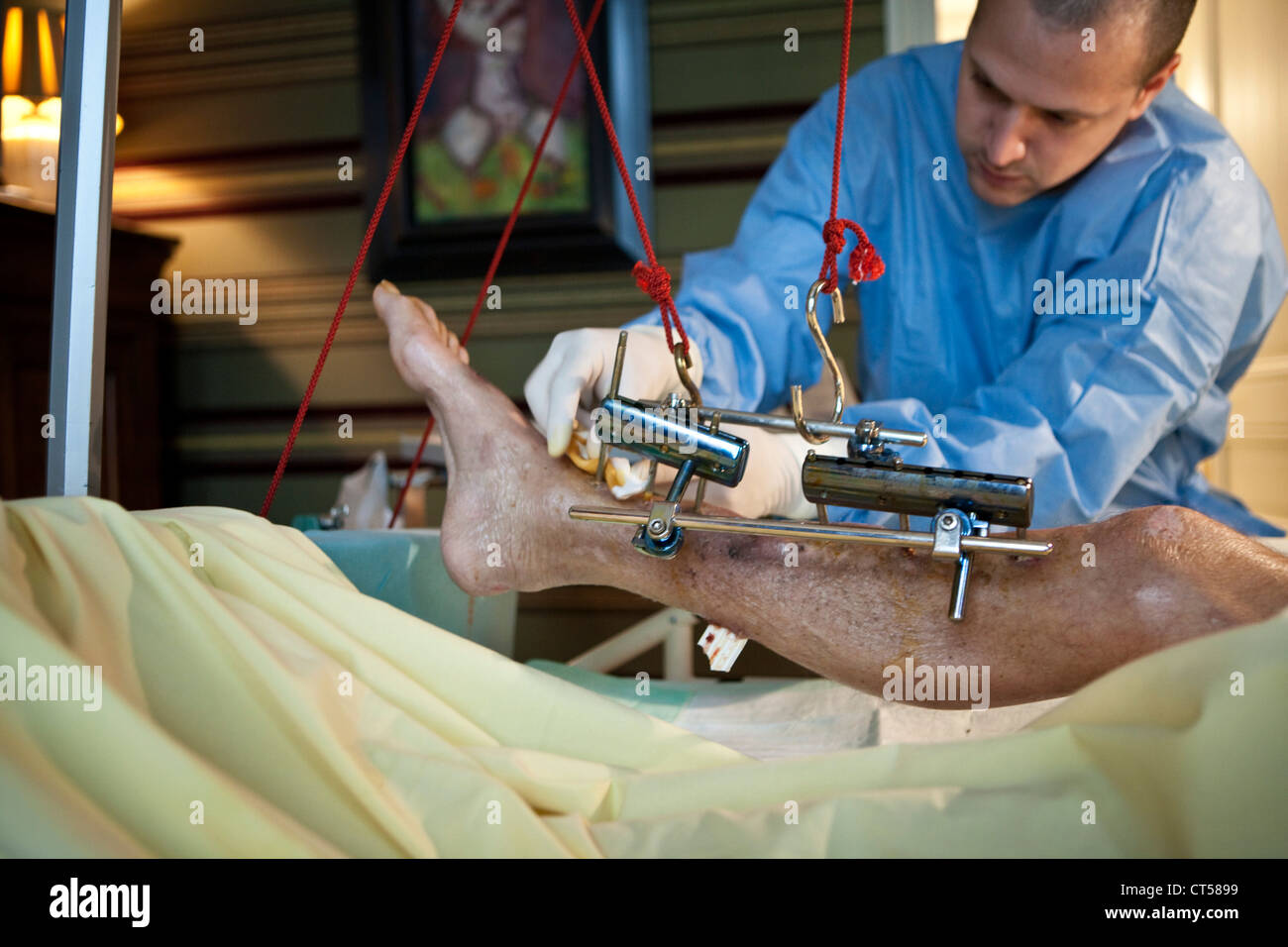 Externe fixierungsvorrichtung -Fotos und -Bildmaterial in hoher Auflösung – Alamy