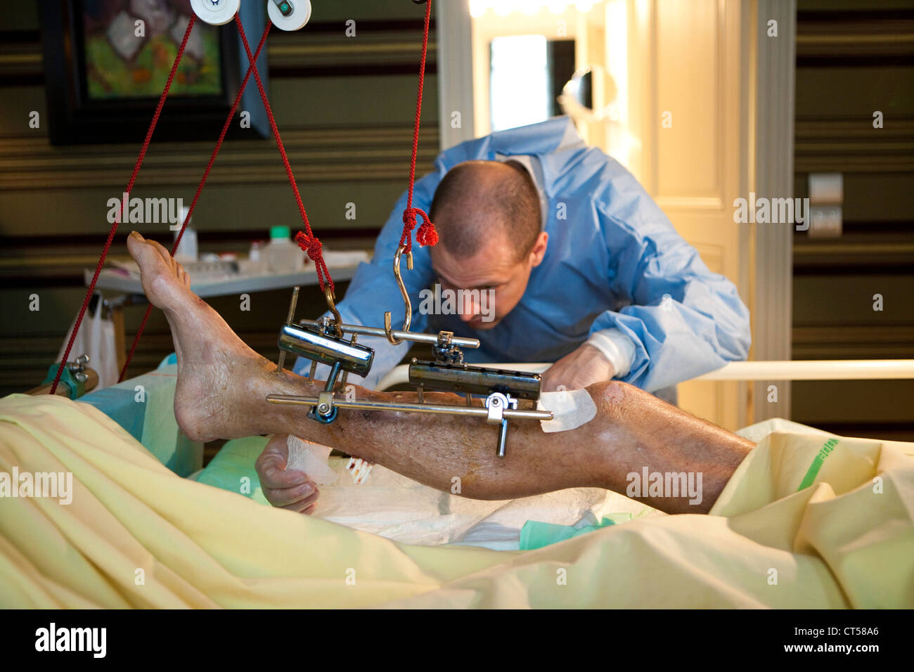 Externe fixierungsvorrichtung -Fotos und -Bildmaterial in hoher Auflösung – Alamy