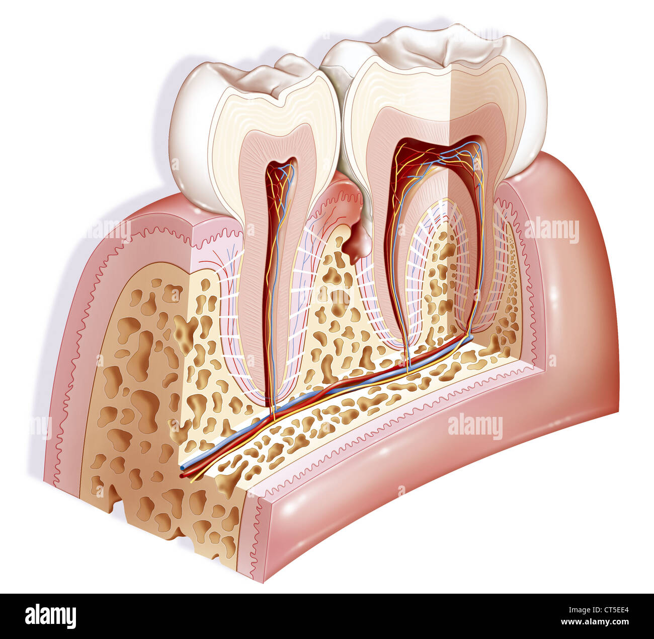 Periodontal disease teeth -Fotos und -Bildmaterial in hoher Auflösung ...