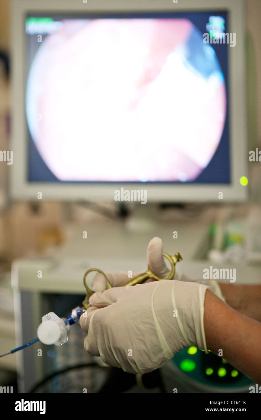 Biopsie probenahme -Fotos und -Bildmaterial in hoher Auflösung – Alamy