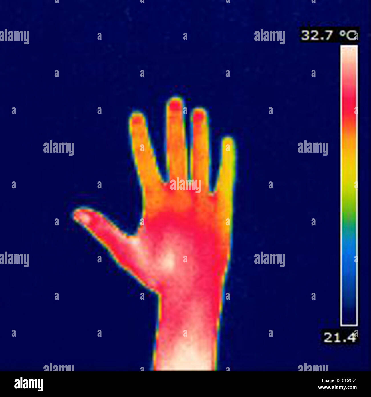Thermogram body -Fotos und -Bildmaterial in hoher Auflösung – Alamy
