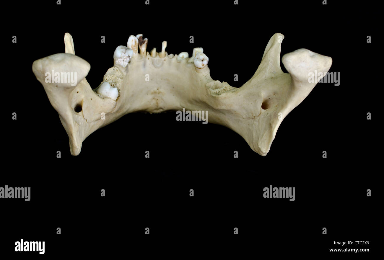Menschlicher Unterkiefer Stockfotos und -bilder Kaufen - Alamy