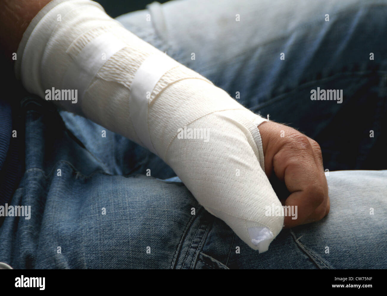 Broken arm with a cast on -Fotos und -Bildmaterial in hoher Auflösung ...