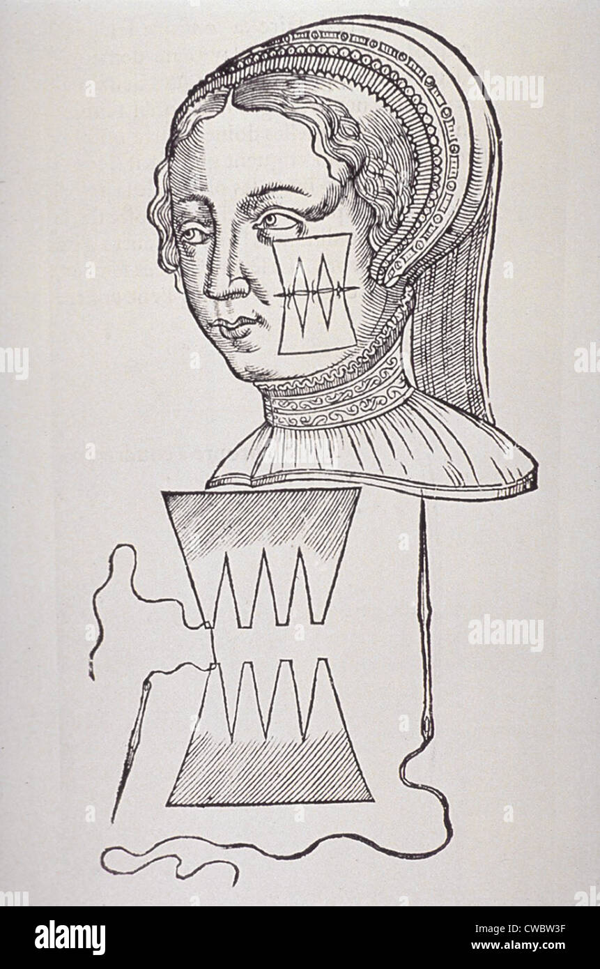 Illustration der Nahttechnik, die aus einer Wunde Gesicht einer Frau ...