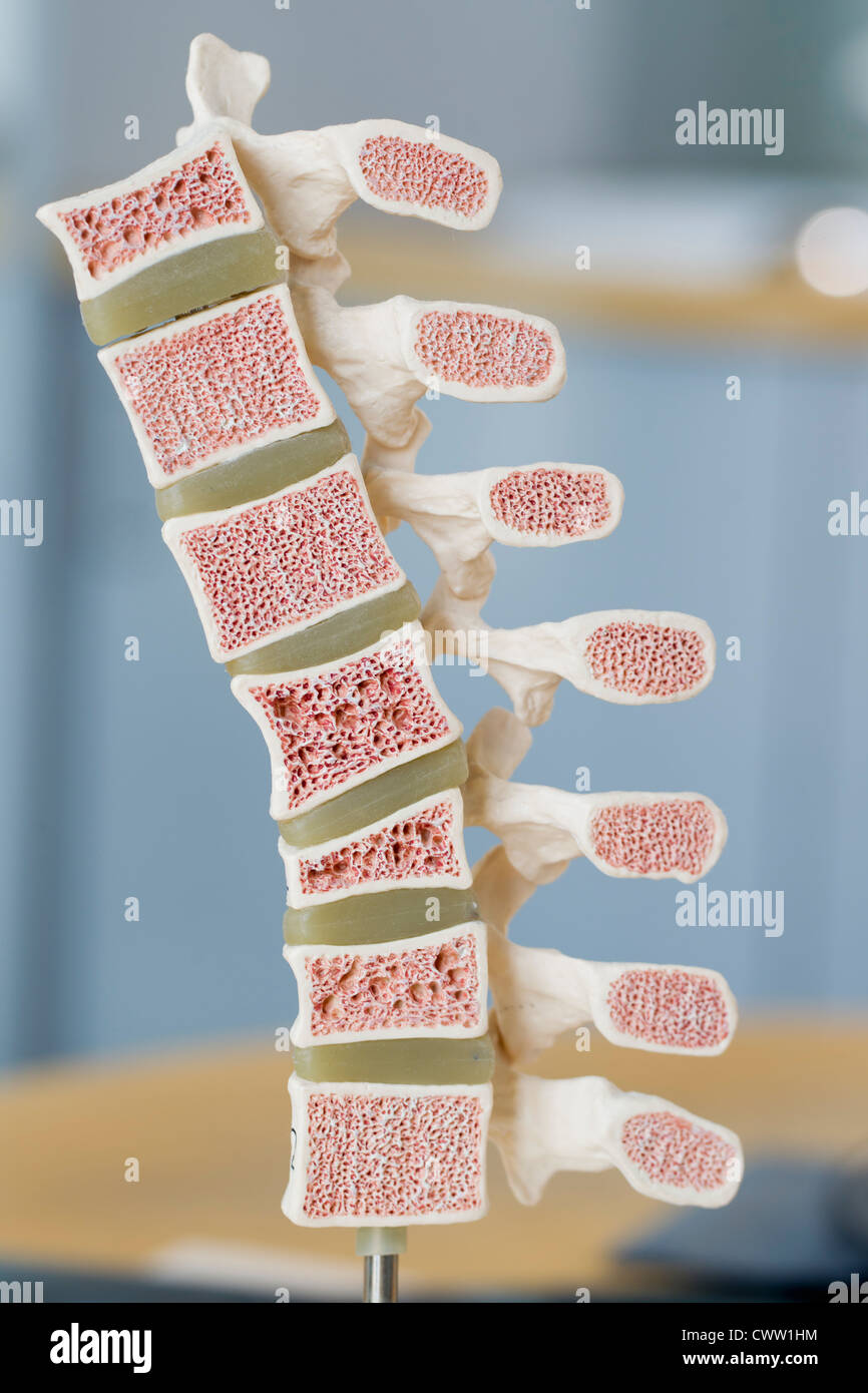 Knochenmodell querschnitt -Fotos und -Bildmaterial in hoher Auflösung ...