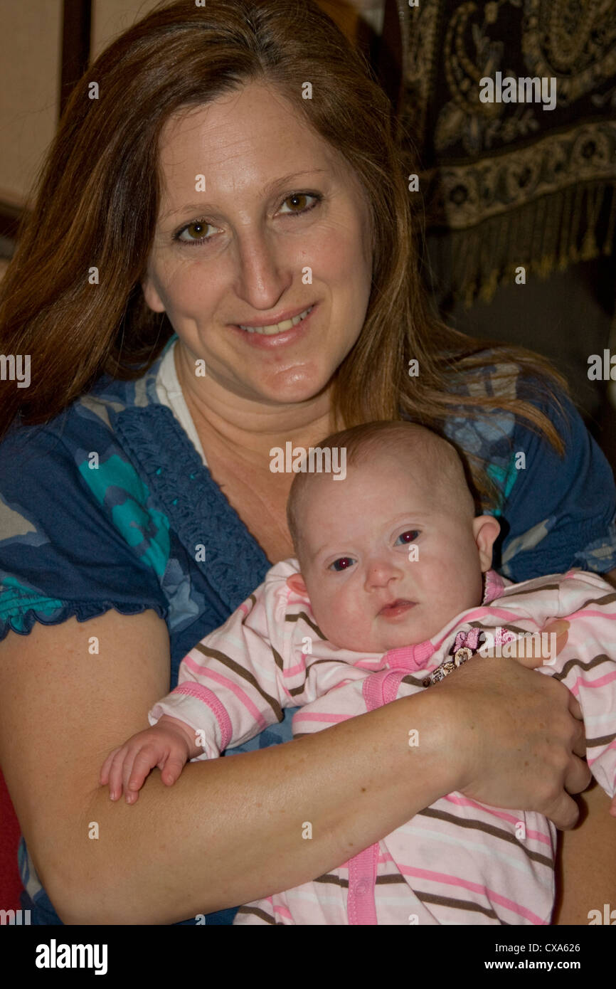 Syndrom baby -Fotos und -Bildmaterial in hoher Auflösung – Alamy