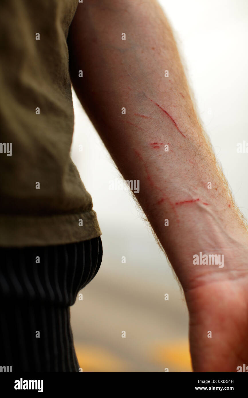 Innerer unterarm Stockfotos und -bilder Kaufen - Alamy