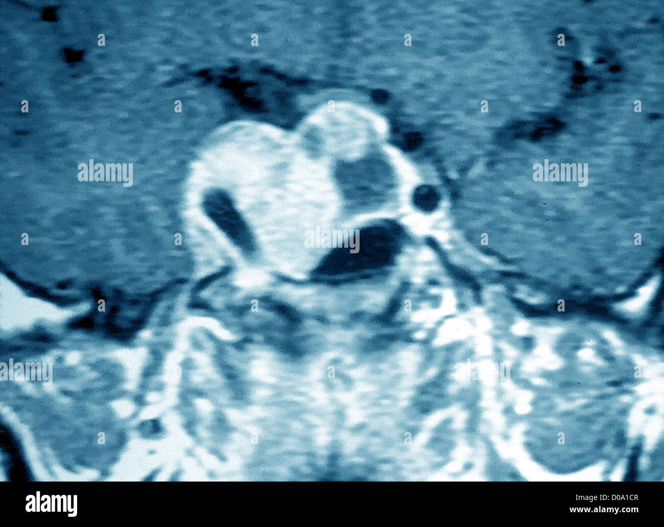 Hypophyse cerebri -Fotos und -Bildmaterial in hoher Auflösung – Alamy
