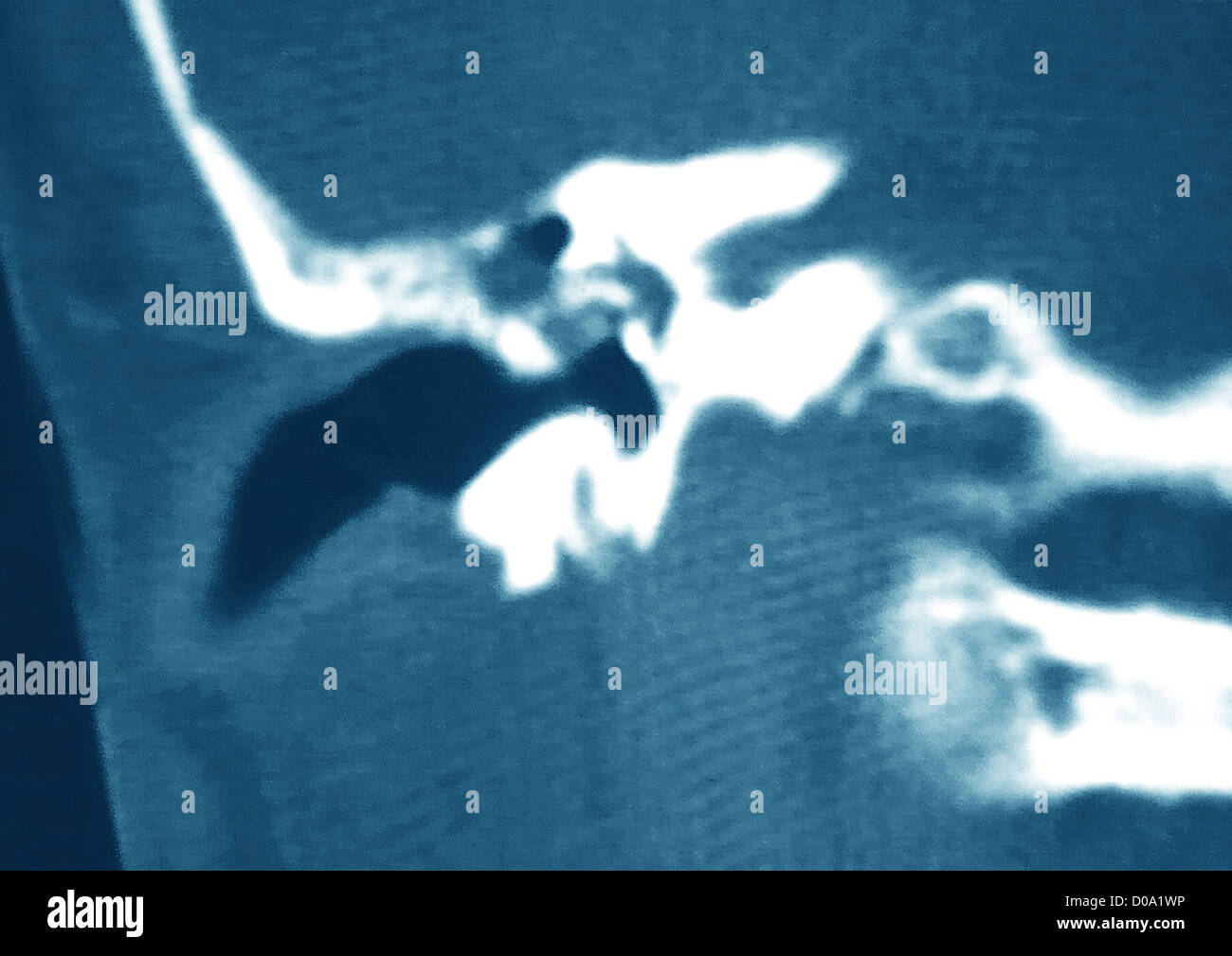 Processus mastoideus -Fotos und -Bildmaterial in hoher Auflösung – Alamy