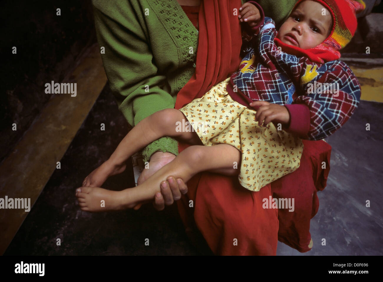 Ausrottung der kinderlähmung Stockfotos und -bilder Kaufen - Alamy