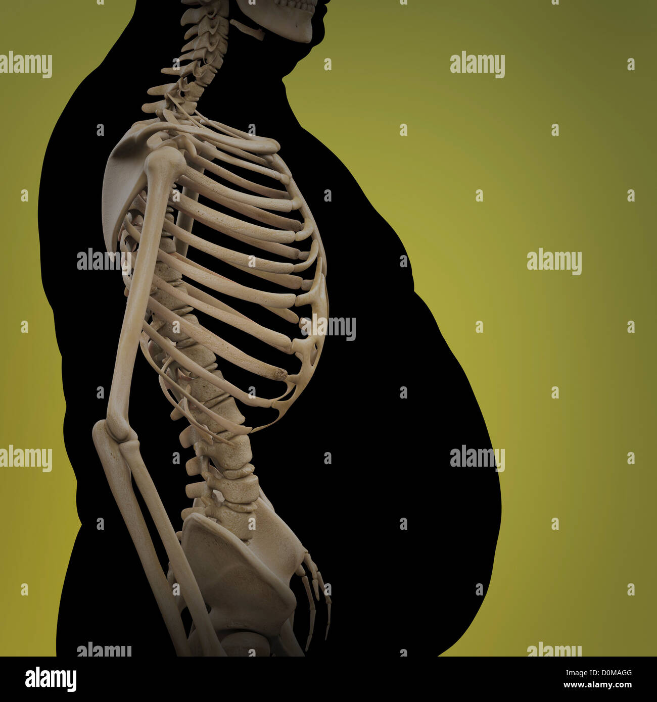 Fat Man Silhouette Overweight Stockfotos & Fat Man Silhouette ...