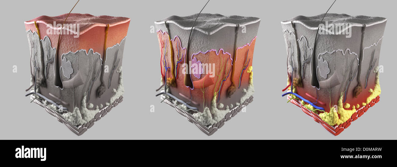 Drei Querschnitte der Haut, der Epidermis, Dermis und Subkutis Layern ...