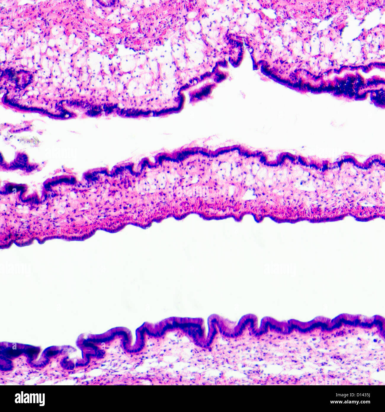 Respiratorisches epithel -Fotos und -Bildmaterial in hoher Auflösung ...