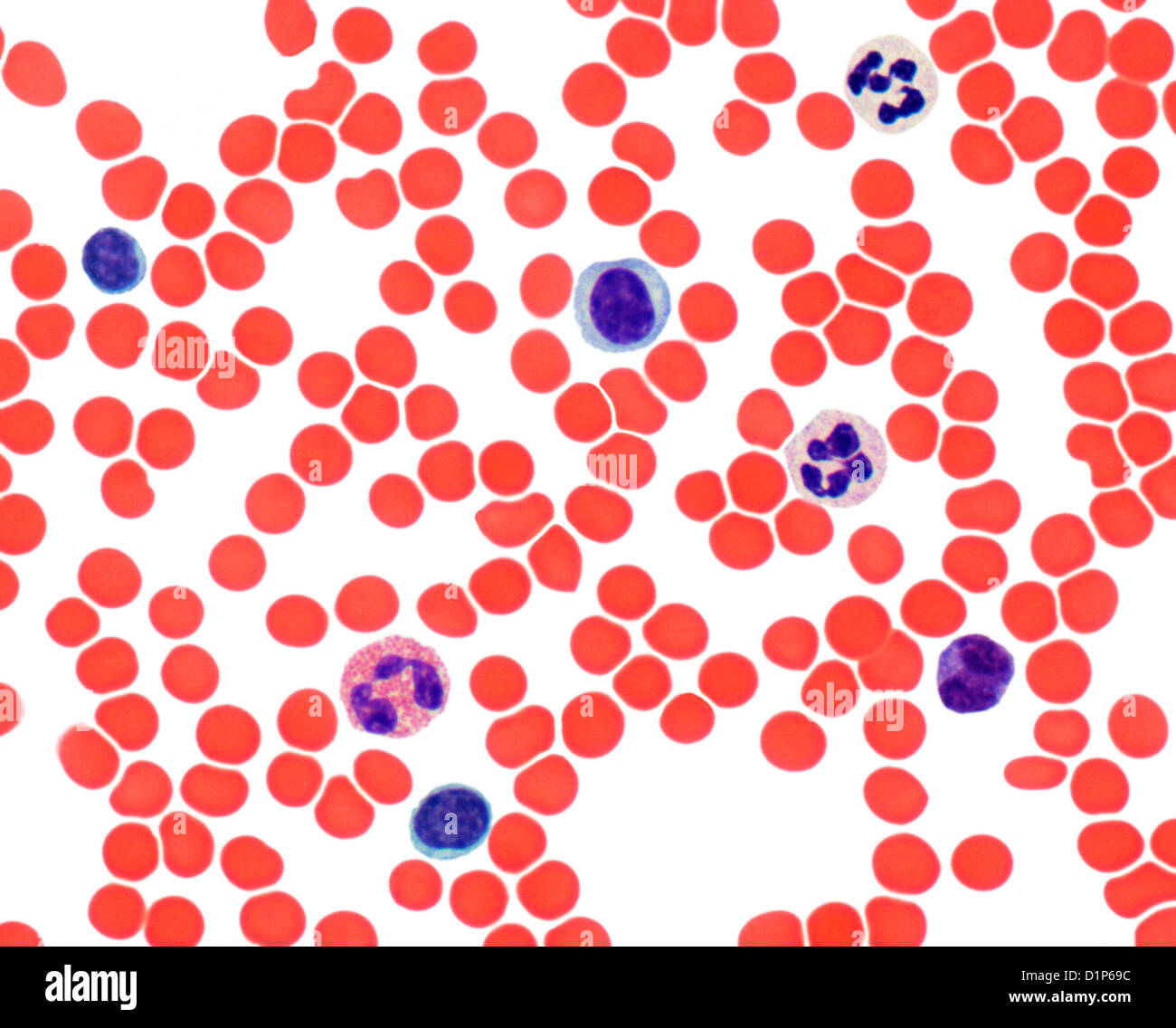 Blood smear micrograph -Fotos und -Bildmaterial in hoher Auflösung – Alamy