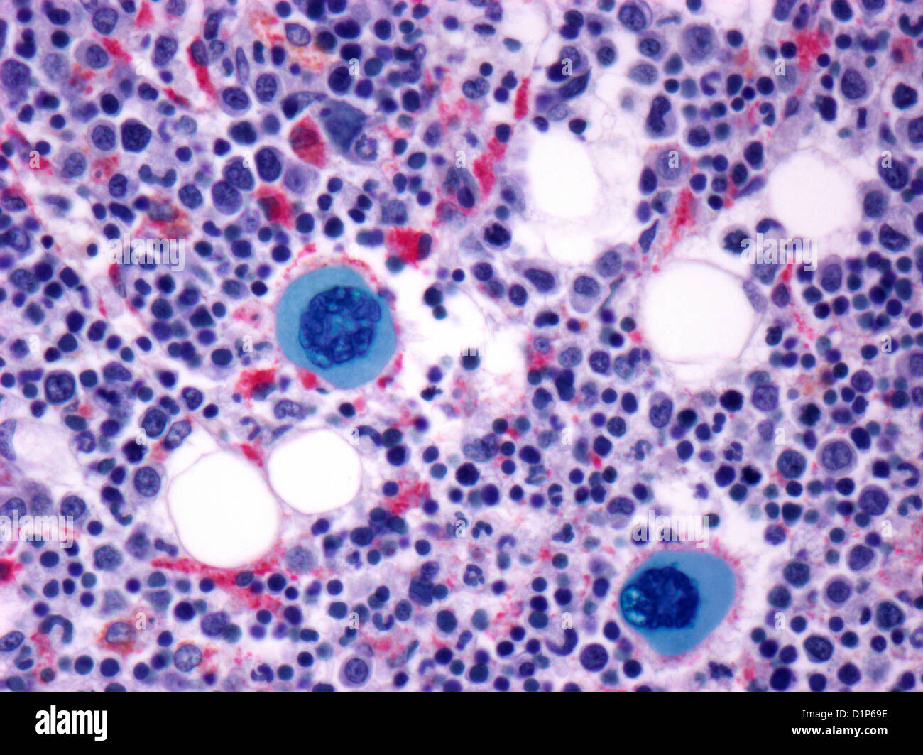Bone Light Micrograph Stockfotos und -bilder Kaufen - Alamy