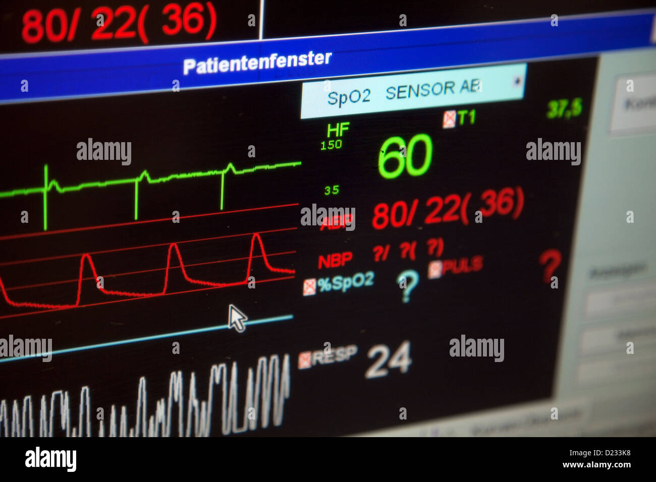 Vitalzeichen Überwachen Stockfotos und -bilder Kaufen - Alamy