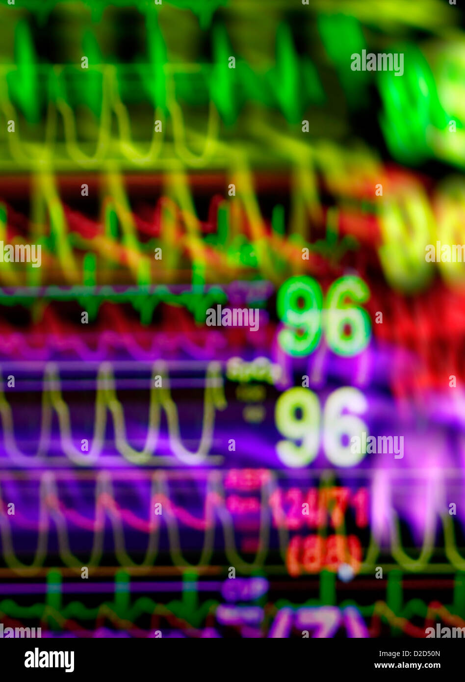 Vital signs monitor -Fotos und -Bildmaterial in hoher Auflösung – Alamy