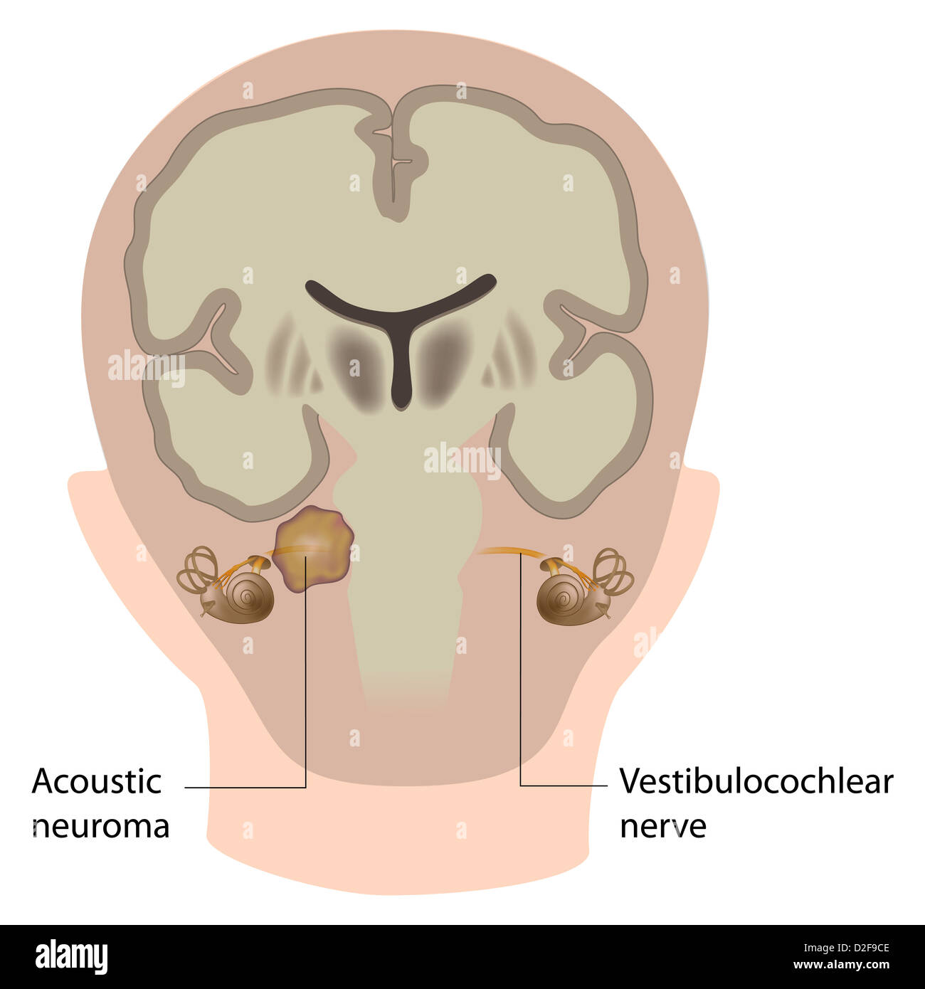 Nerven vestibulocochlearis -Fotos und -Bildmaterial in hoher Auflösung ...