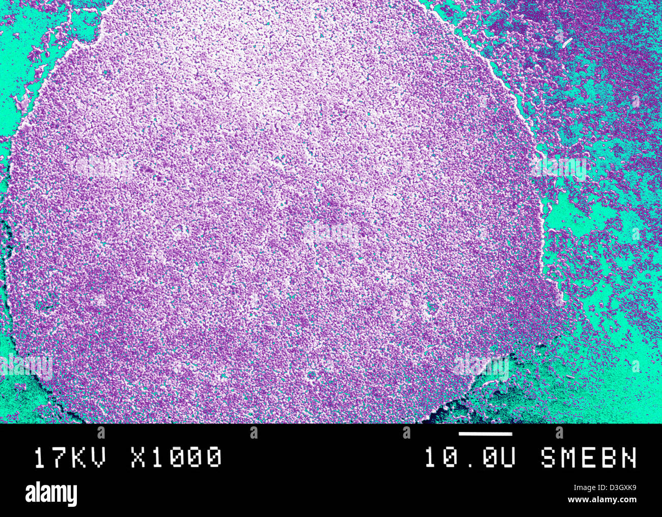 Mycoplasma hominis -Fotos und -Bildmaterial in hoher Auflösung – Alamy
