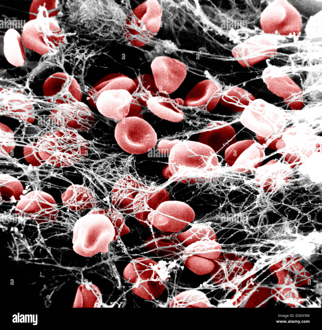 Koagulum fibrin -Fotos und -Bildmaterial in hoher Auflösung – Alamy