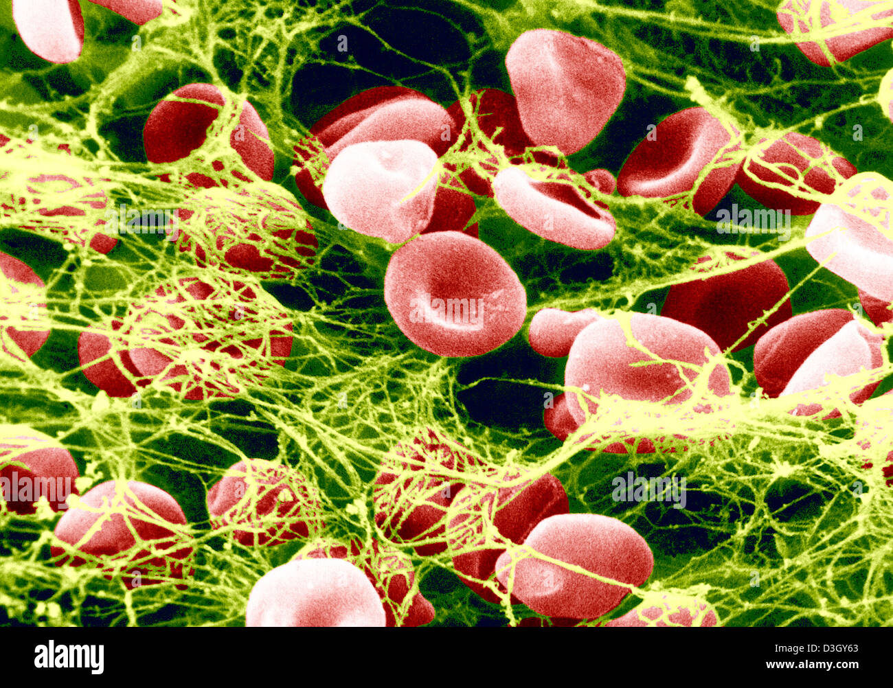 Koagulum fibrin -Fotos und -Bildmaterial in hoher Auflösung – Alamy