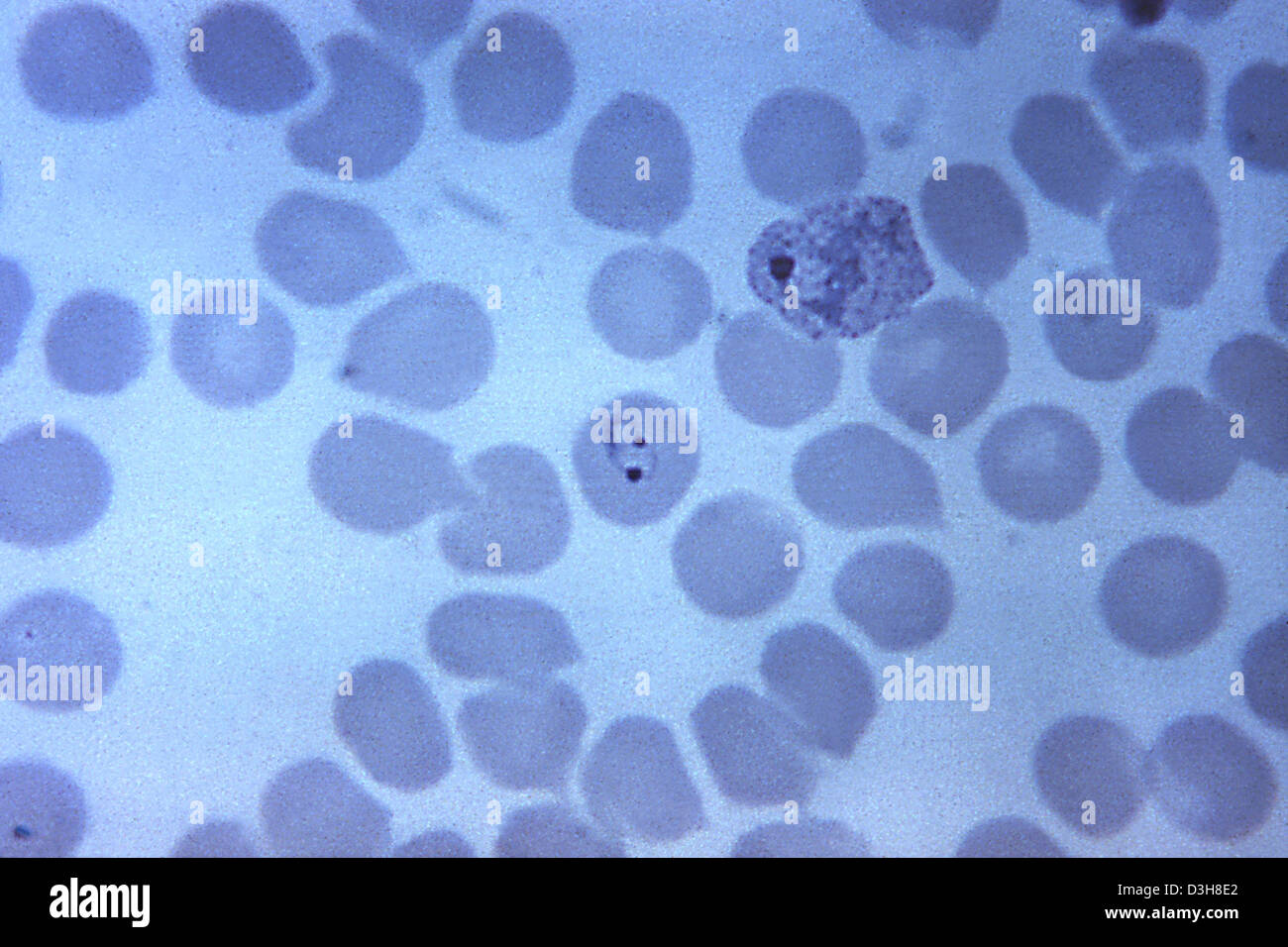 Plasmodium vivax -Fotos und -Bildmaterial in hoher Auflösung – Alamy