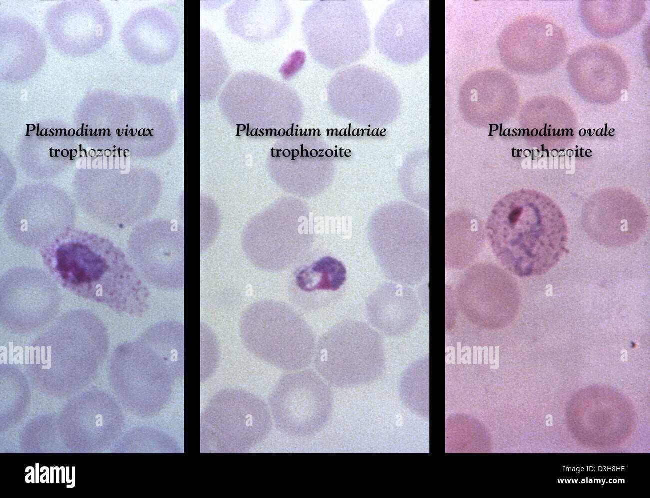 Blood smear micrograph -Fotos und -Bildmaterial in hoher Auflösung – Alamy
