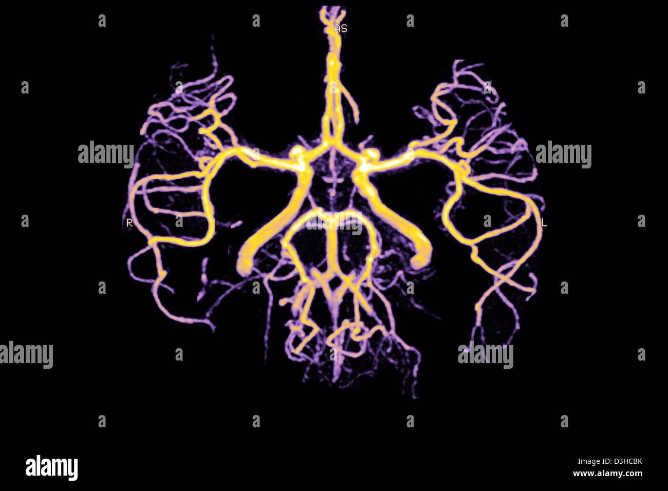 Circulus arteriosus willisii -Fotos und -Bildmaterial in hoher ...