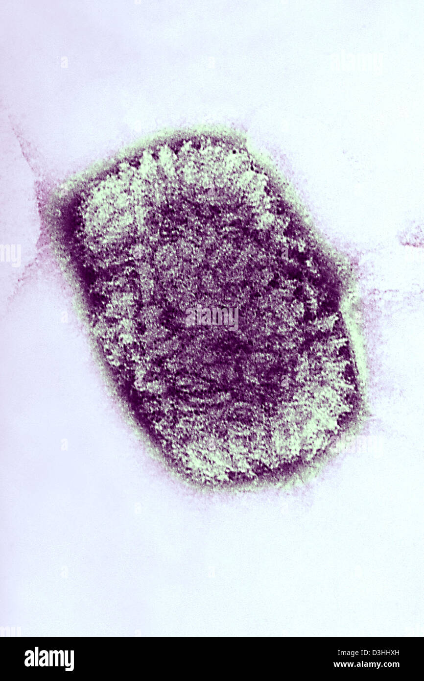 Vaccinia Virus Stockfotos und -bilder Kaufen - Alamy