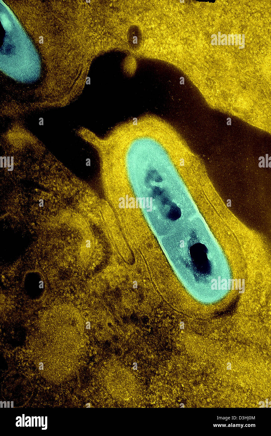 Listeria monocytogenes bacteria -Fotos und -Bildmaterial in hoher ...