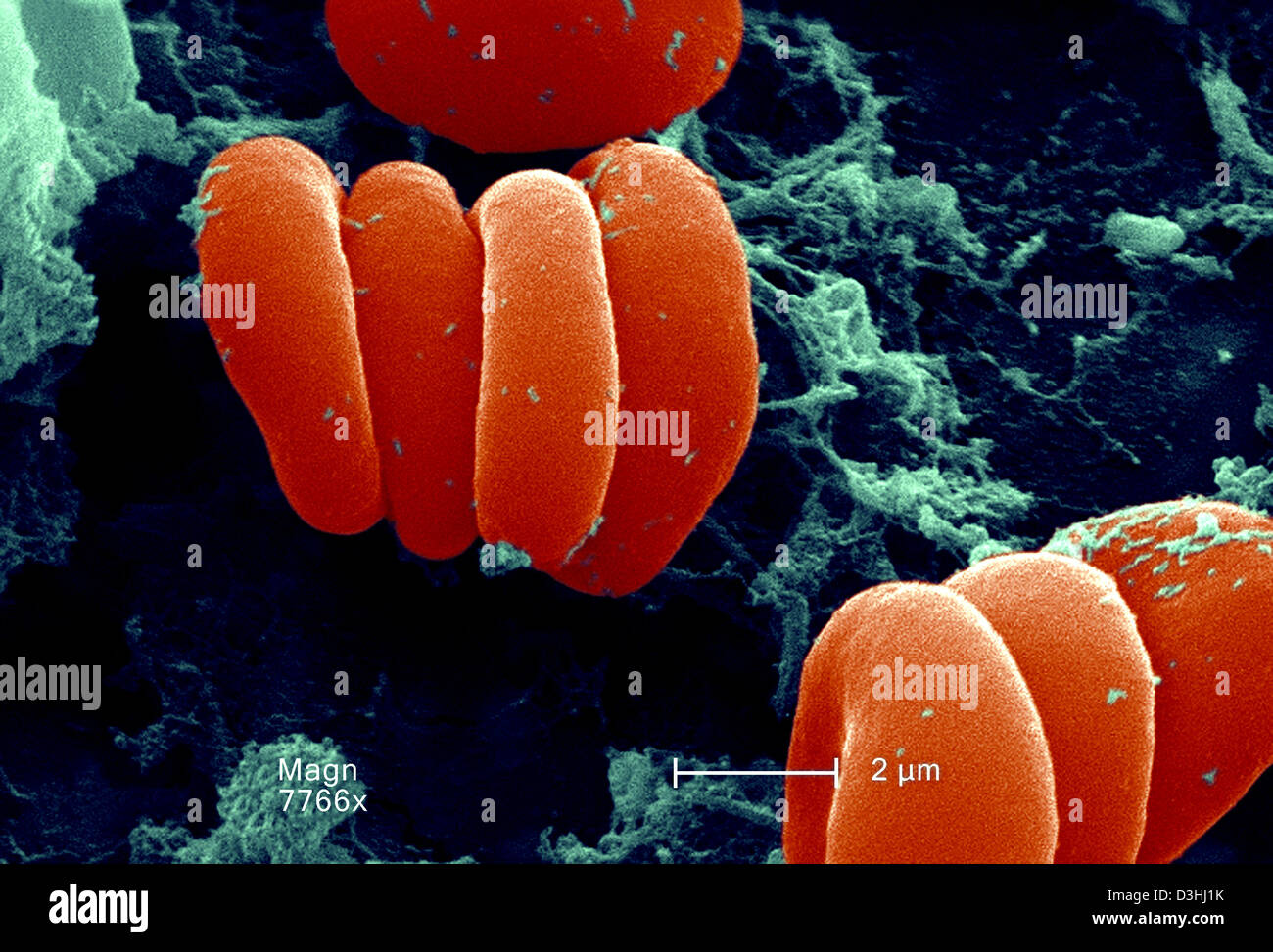 Koagulum fibrin -Fotos und -Bildmaterial in hoher Auflösung – Alamy