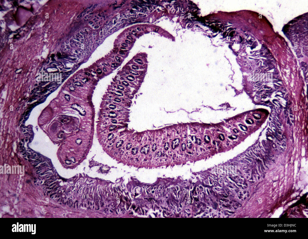Ductus biliaris -Fotos und -Bildmaterial in hoher Auflösung – Alamy