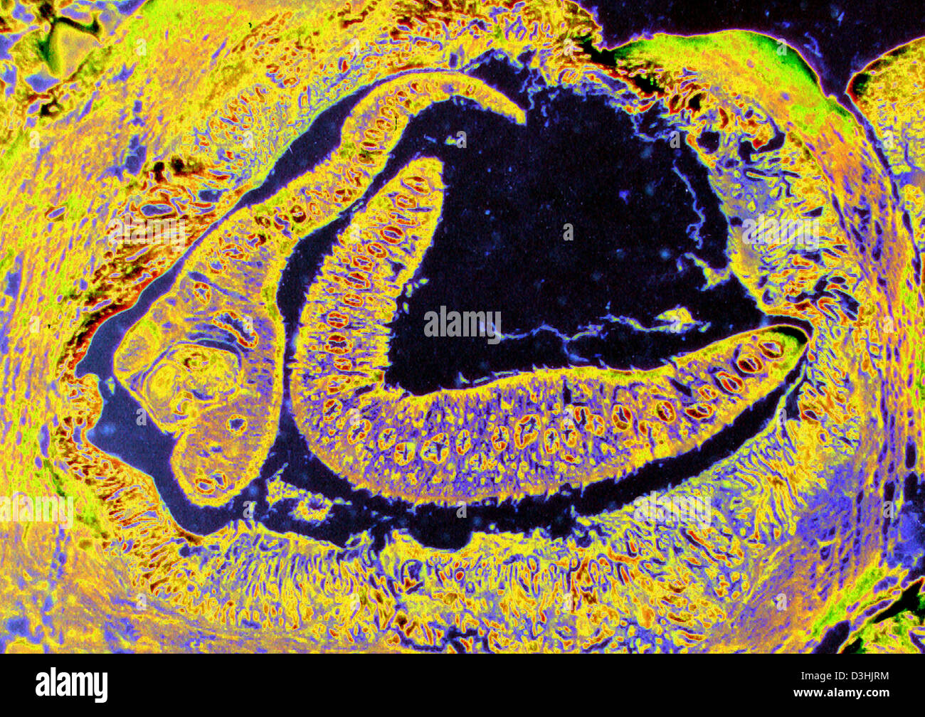 Ductus biliaris -Fotos und -Bildmaterial in hoher Auflösung – Alamy